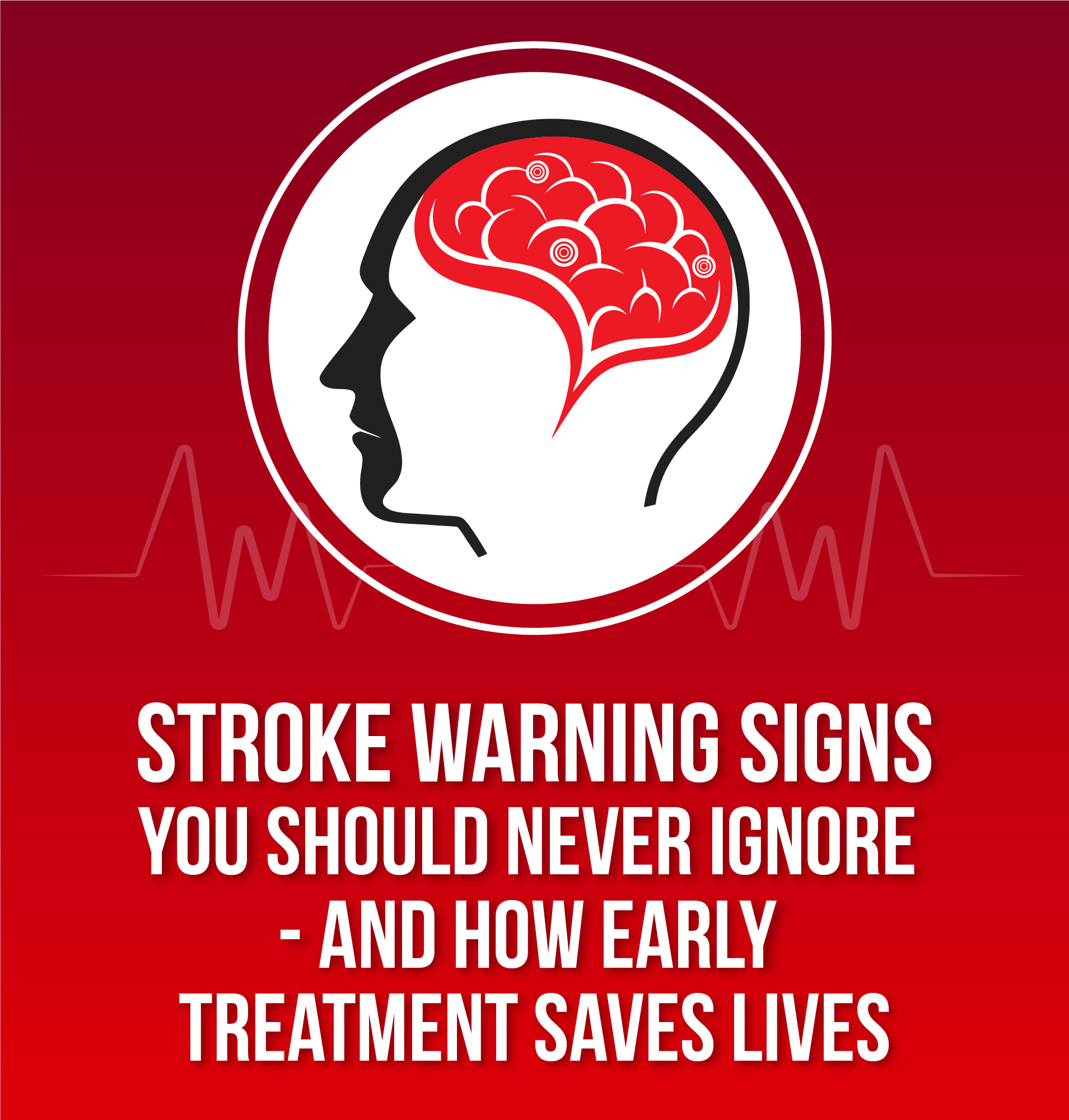 Stroke Warning Signs You Should Never Ignore